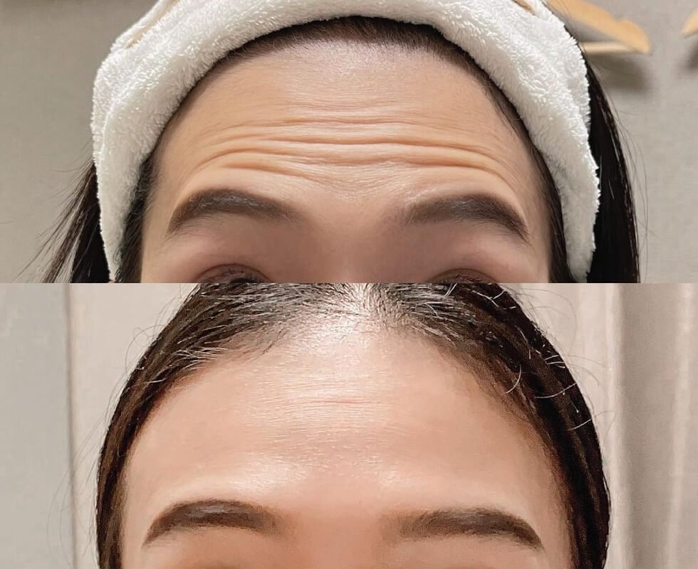 Vichen คืออะไรอะไรผลิตภัณฑ์ครีมแท้ราคารีวิวของซื้อที่ไหนวิธีนวดเทศไทย ...