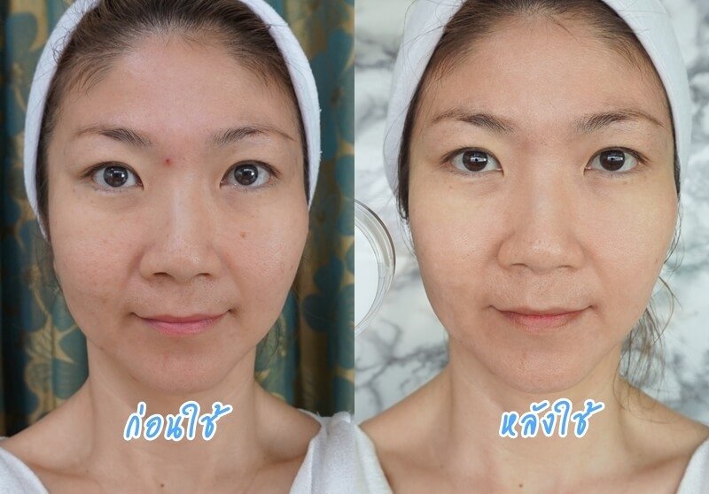 Vichen คืออะไรอะไรผลิตภัณฑ์ครีมแท้ราคารีวิวของซื้อที่ไหนวิธีนวดเทศไทย ...