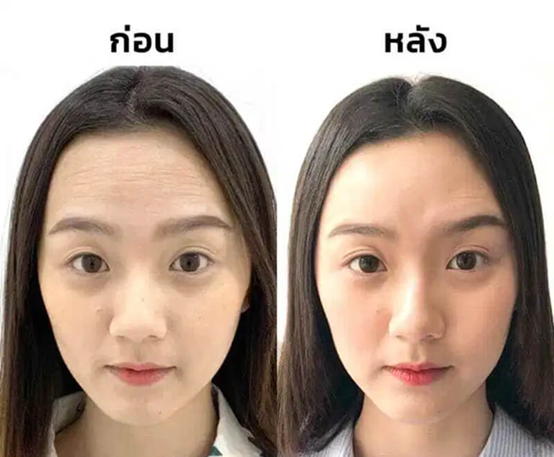 Vichen คืออะไรอะไรผลิตภัณฑ์ครีมแท้ราคารีวิวของซื้อที่ไหนวิธีนวดเทศไทย ...